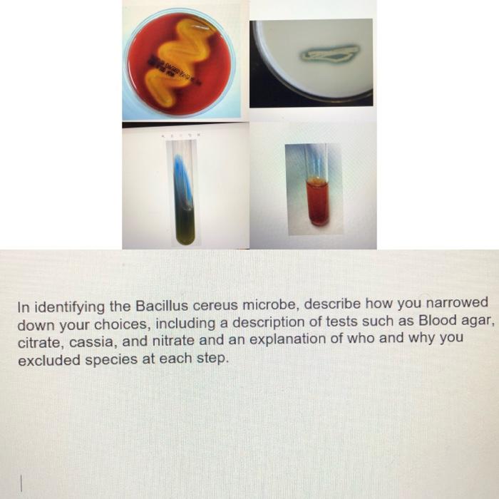 Solved In identifying the Bacillus cereus microbe, describe | Chegg.com