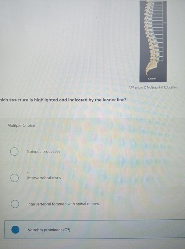 Solved APR photo O McGraw-Hill Educationhich structure is | Chegg.com