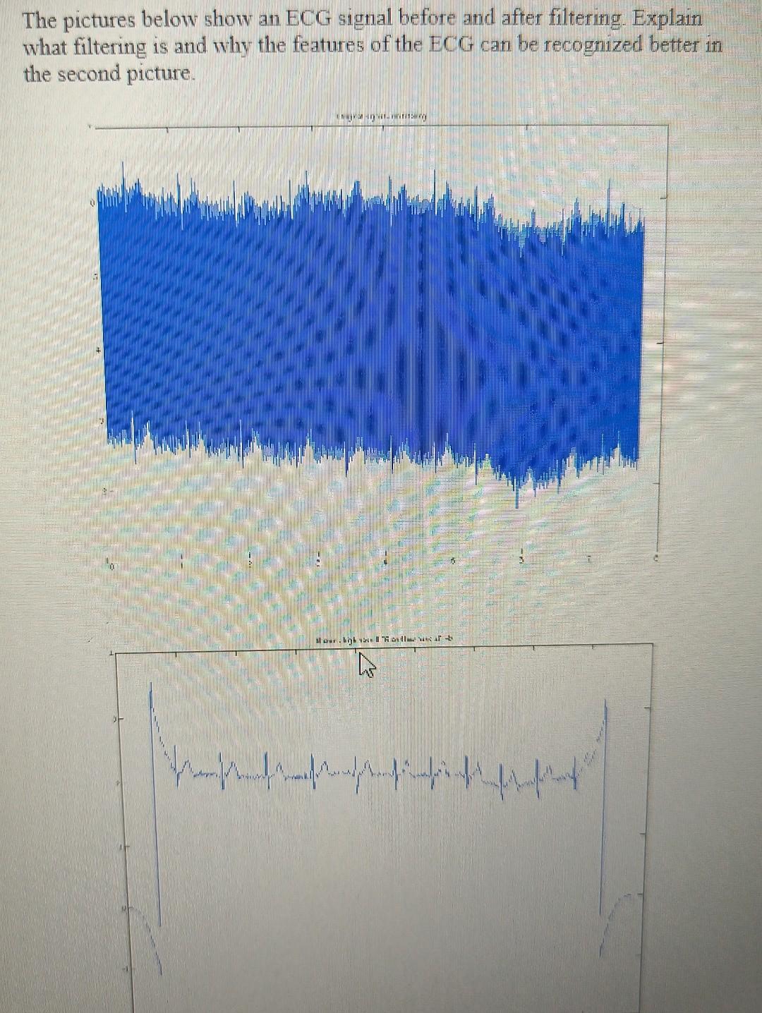 Solved The pictures below show an ECG signal before and | Chegg.com
