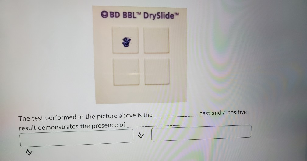 Solved OBD BBL™ DrySlide test and a positive The test | Chegg.com
