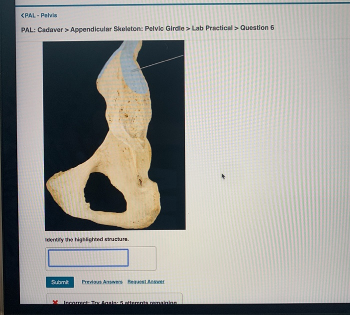 Solved Appendicular Skeleton: Pelvic Girdle > Lab Practical | Chegg.com