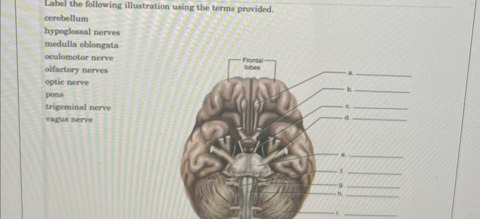 Solved Label the following illustration using the terms | Chegg.com