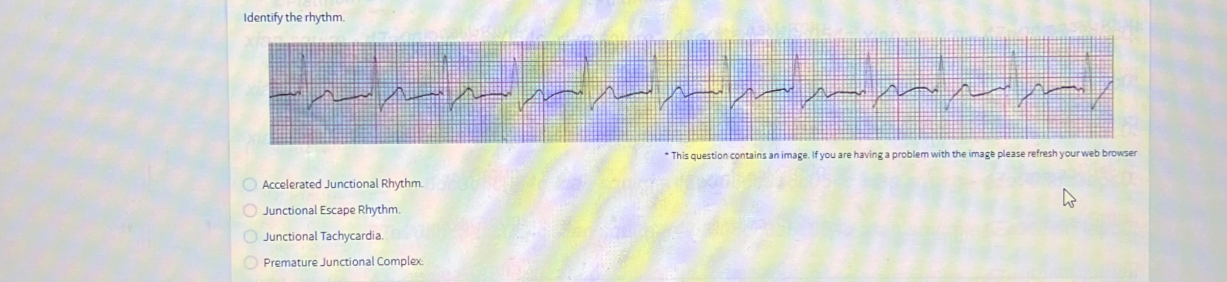 Solved Identify the rhythm.This question contains an image. | Chegg.com