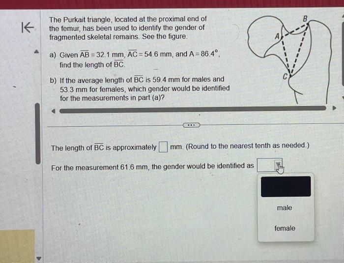 Solved The Purkait triangle, located at the proximal end of | Chegg.com