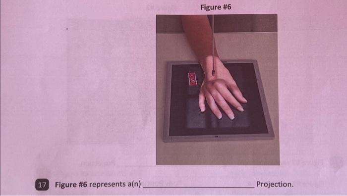 Solved Figure \#6 7 Figure #6 represents a(n) Projection. | Chegg.com