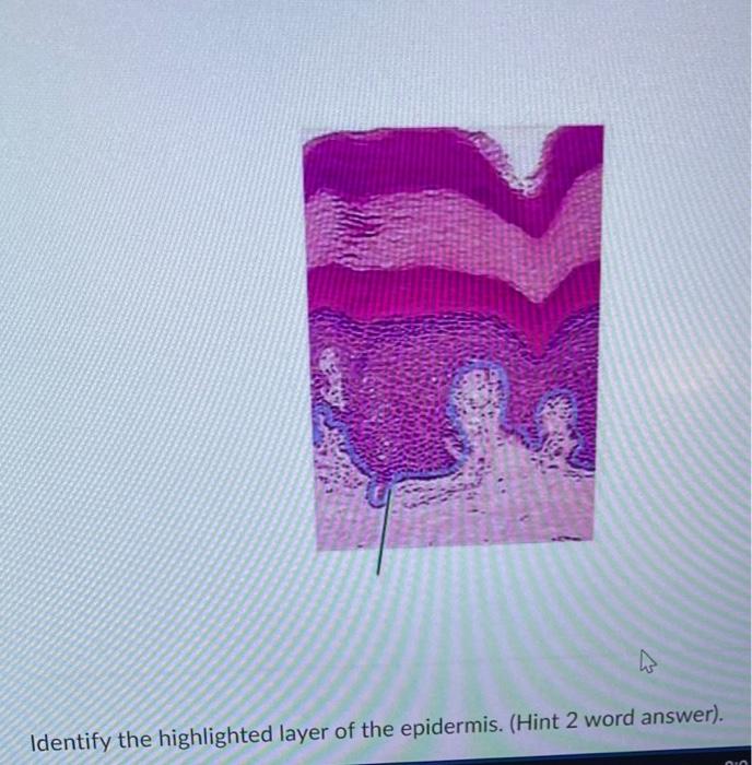 Solved Identify the highlighted layer of the epidermis. | Chegg.com