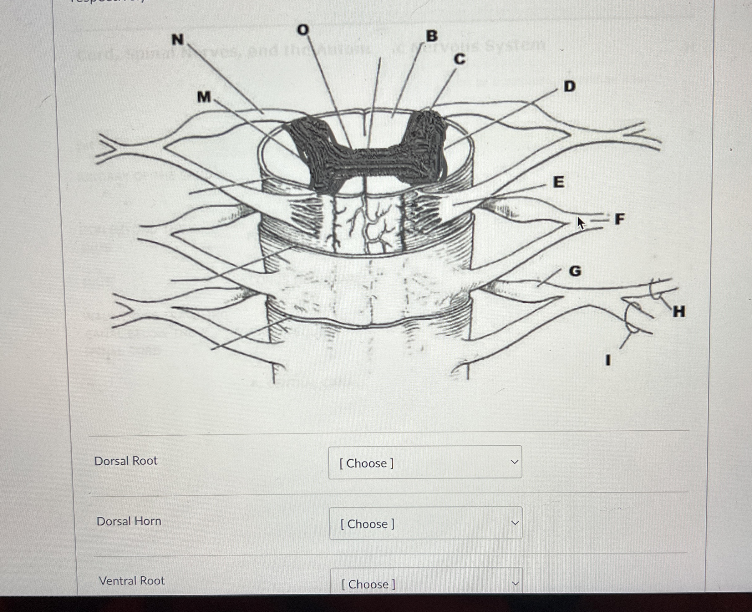 Solved Dorsal RootDorsal HornVentral RootLabel the spinal | Chegg.com