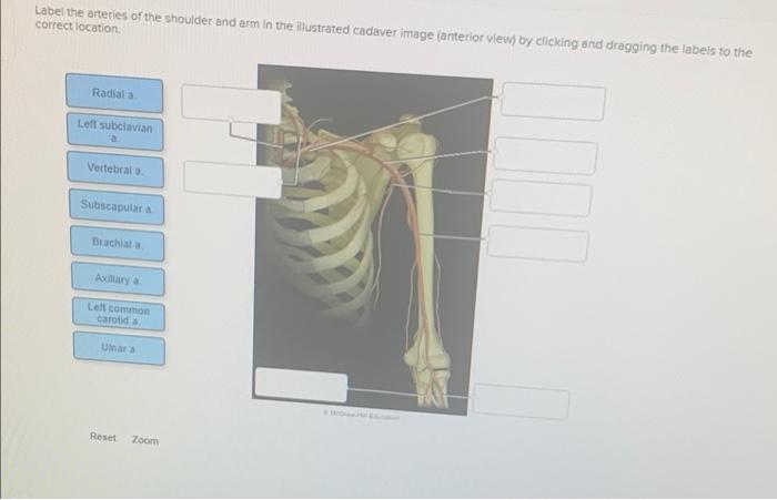 Solved Label the arteries of the shoulder and arm in the | Chegg.com