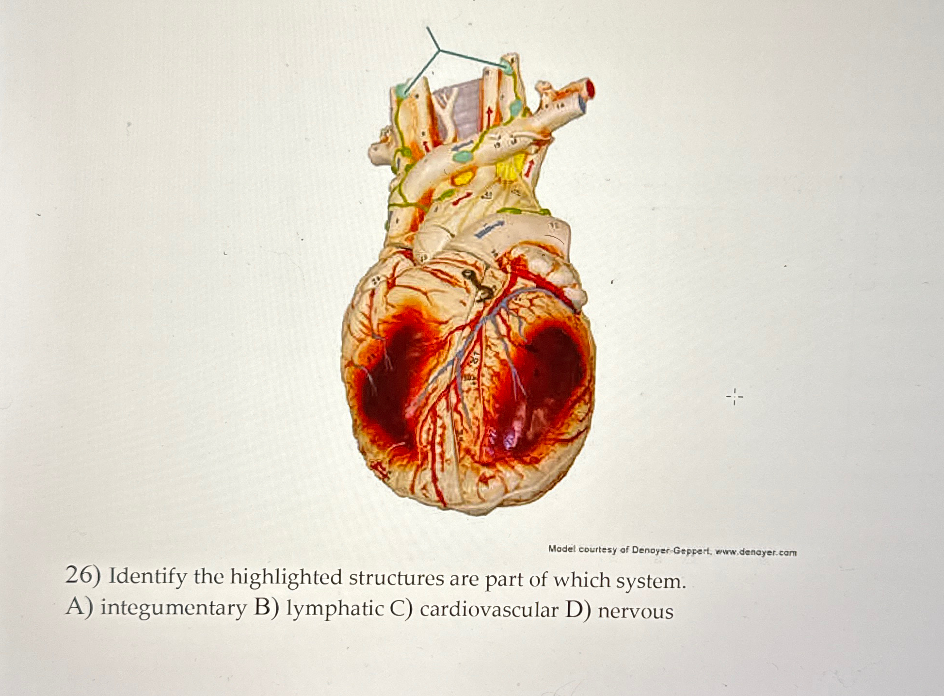 Solved Model courtesy of Denoyer Geppert, whw, | Chegg.com