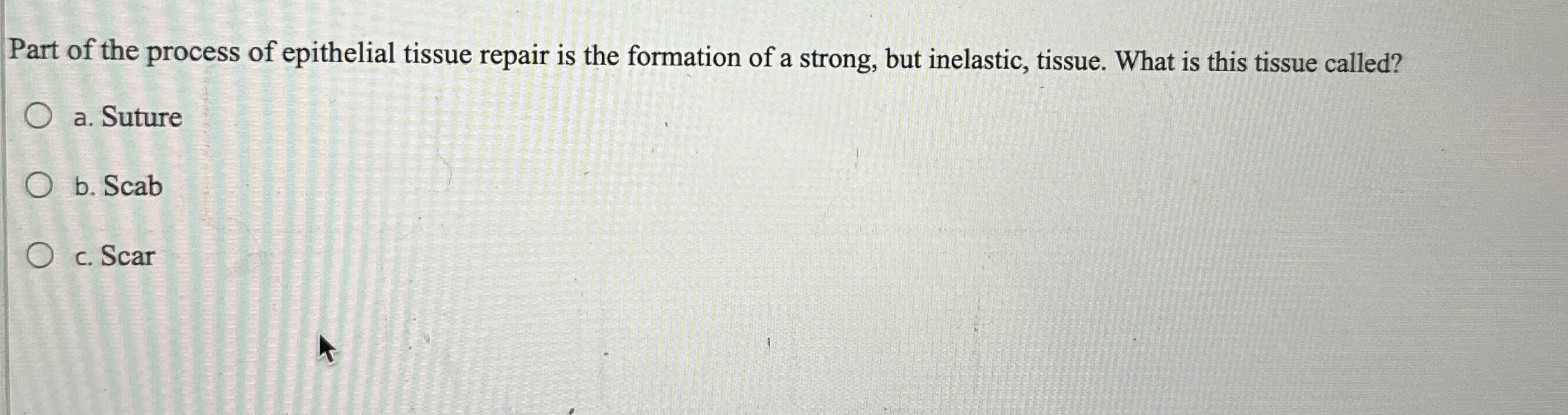 Solved Part of the process of epithelial tissue repair is | Chegg.com