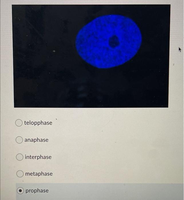 Solved Below is the nucleus of a DAPI-stained cell. What | Chegg.com