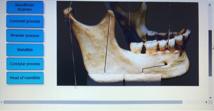 Solved Label the structures of the bone using the hints | Chegg.com