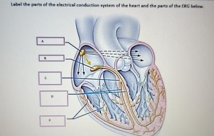 Solved Label the parts of the electrical conduction system | Chegg.com