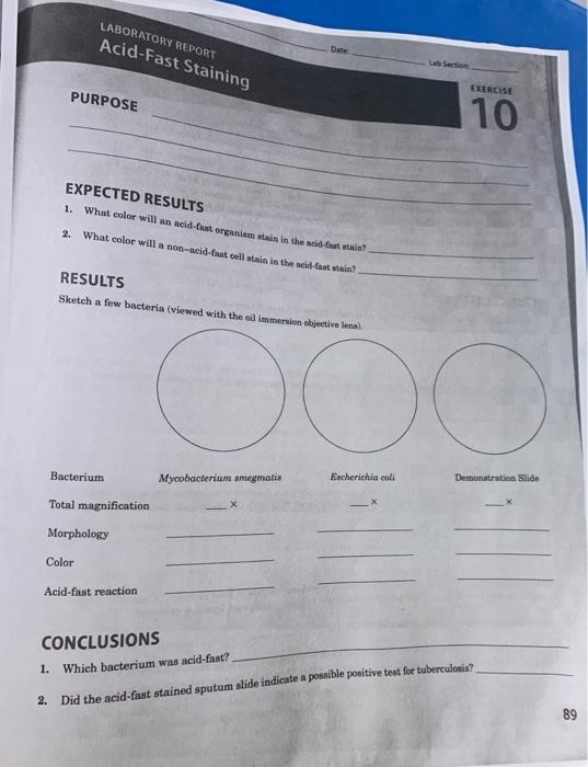 Solved LABORATORY REPORT Acid-Fast Staining De EXERCISE | Chegg.com
