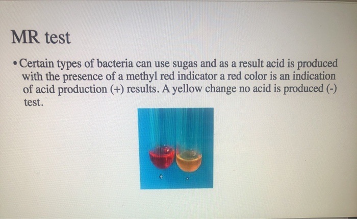 Solved Differentiation test Sucrose Fermentation Test • | Chegg.com