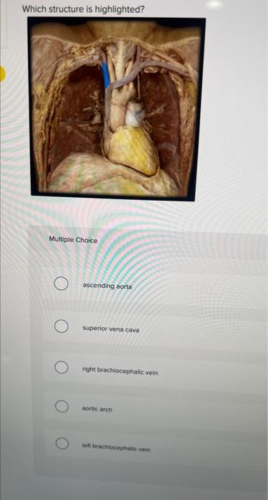Solved Which structure is highlighted? Multiple Choice | Chegg.com
