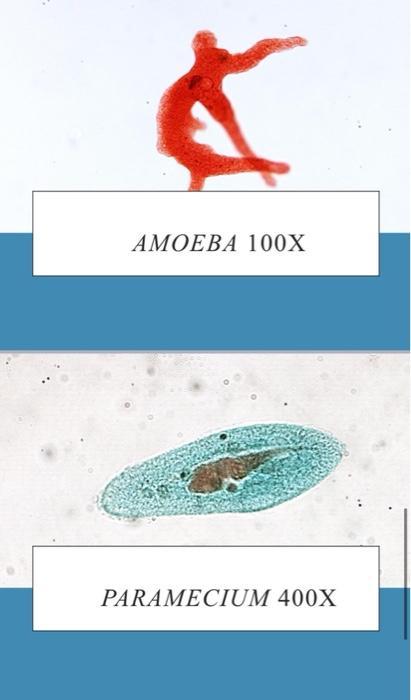 Solved ELODEA LEAF 400X ONION EPIDERMIS 100X HUMAN | Chegg.com