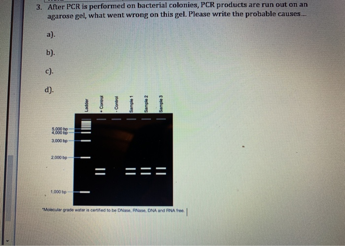 Solved After PCR is performed on bacterial colonies, PCR | Chegg.com