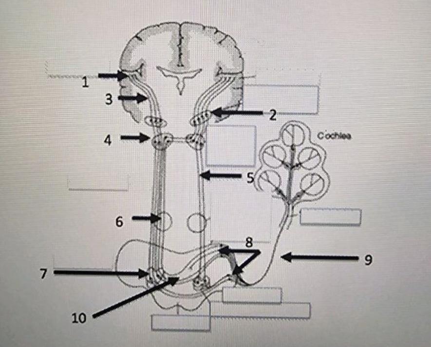 Solved Where is the auditory Cortex? | Chegg.com