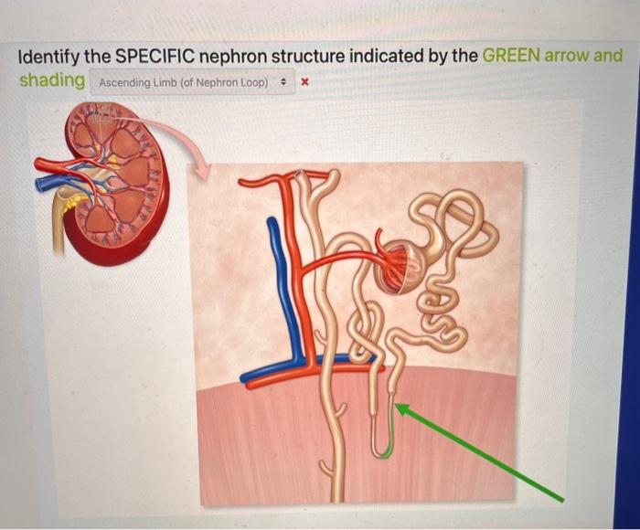 Solved Identify the SPECIFIC nephron structure indicated by | Chegg.com