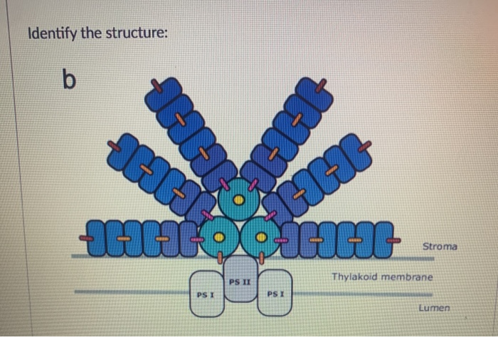 Solved Identify the structure: b Alate that una Stroma | Chegg.com