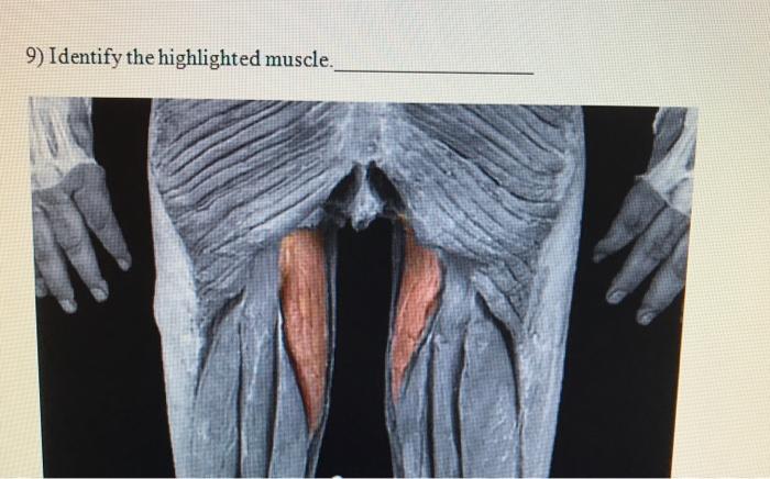 Solved 10) Identify the highlighted muscle. 9) Identify | Chegg.com Solved 10) Identify the highlighted muscle. 9) Identify | Chegg.com