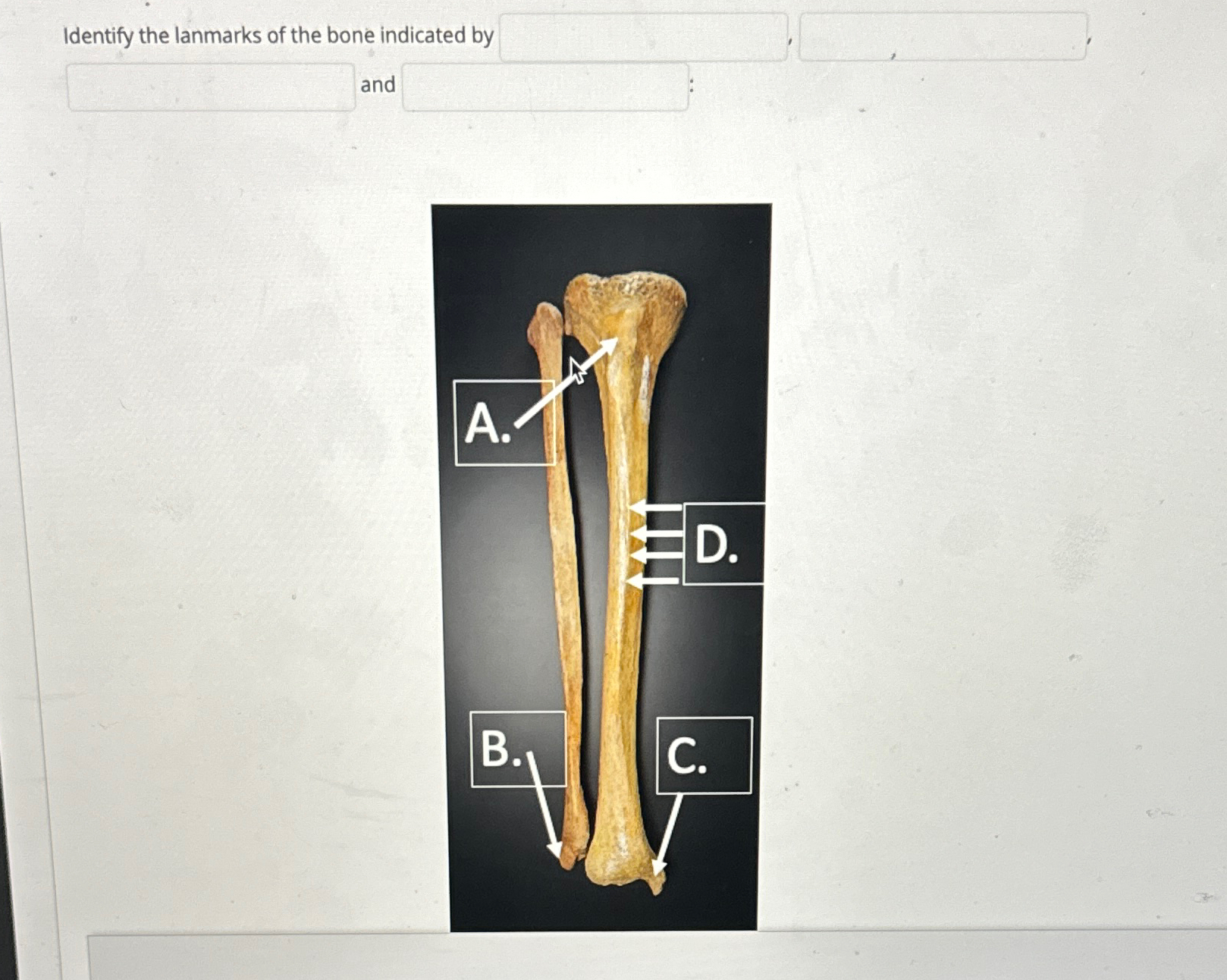 Solved Identify the lanmarks of the bone indicated band | Chegg.com