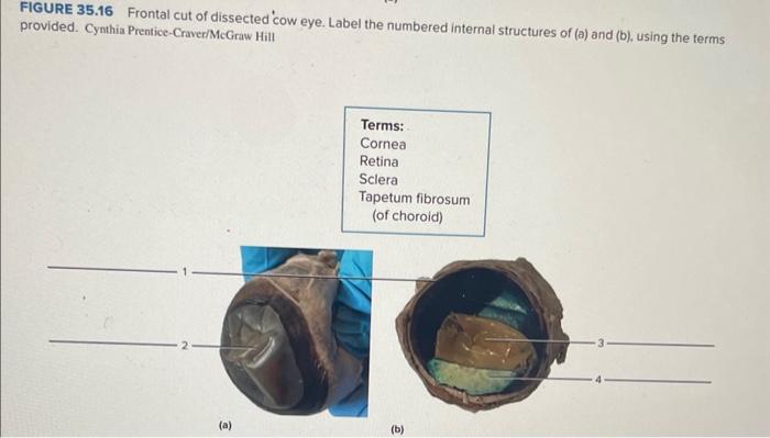 Solved FIGURE 35.16 Frontal cut of dissected cow eye. Label | Chegg.com