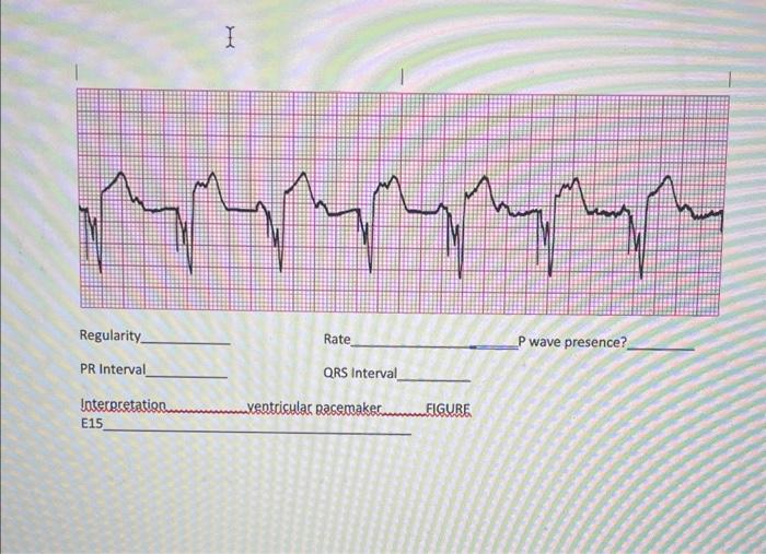 Solved Regularity Rate PR Interval QRS Interval | Chegg.com