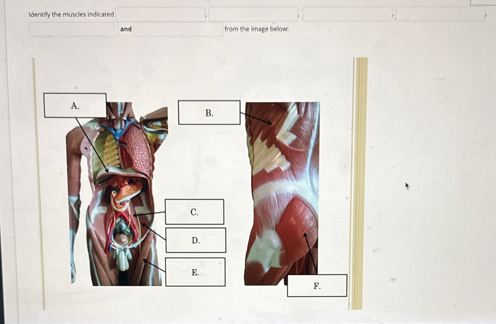 Solved Identify the muscles indicatedand from the image | Chegg.com