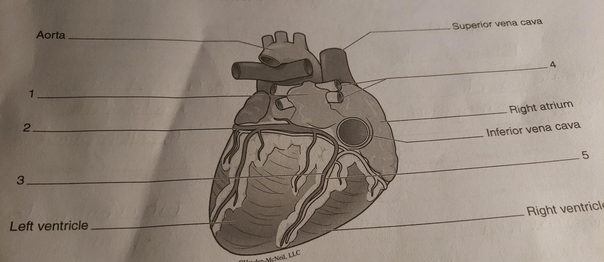 Solved Superior vena cava Right atrium Right ventricle | Chegg.com