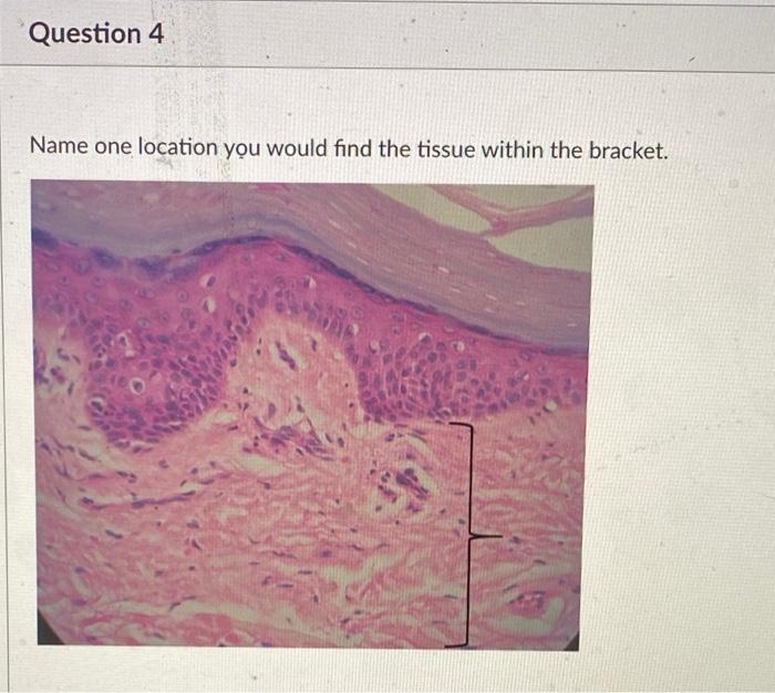 Solved Question 3 What is the function of this tissue? | Chegg.com