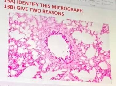 Solved Identify the micrograph give 2 ﻿reason for your | Chegg.com