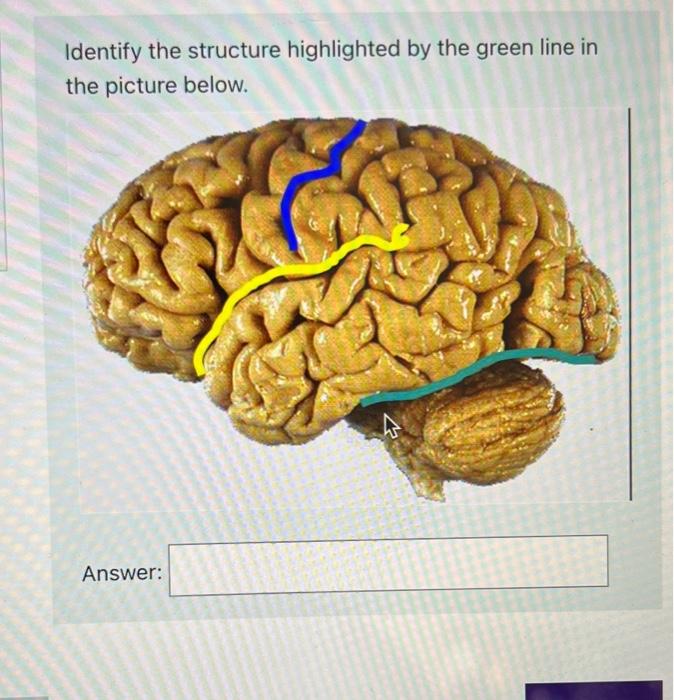 Solved Identify the structure highlighted green in the | Chegg.com