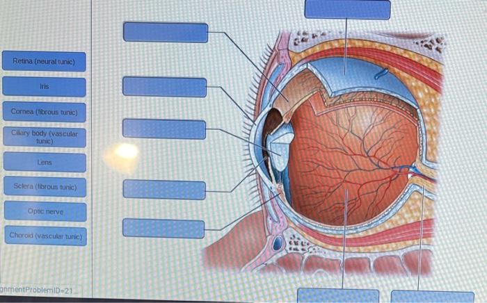 Solved Retina (neural tunic) Iris Cornea (fibrous tunic) | Chegg.com