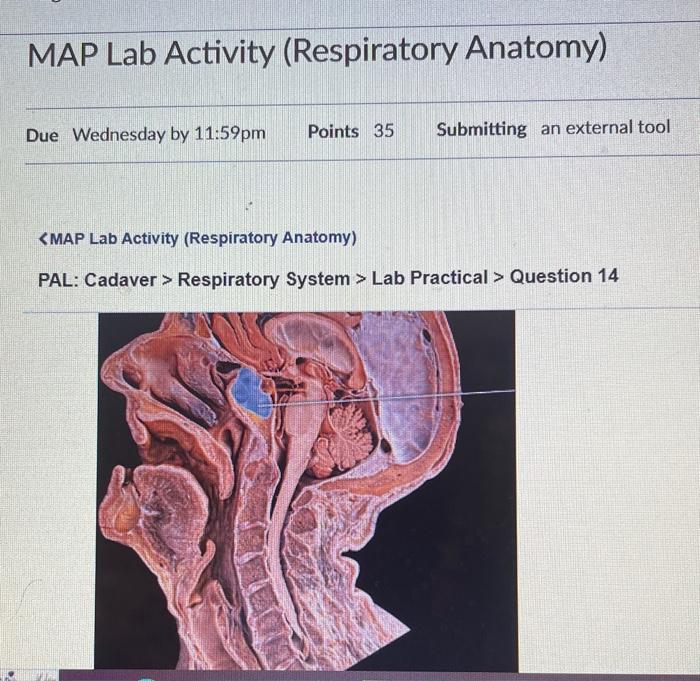 MAP Lab Activity (Respiratory Anatomy) Due Wednesday | Chegg.com