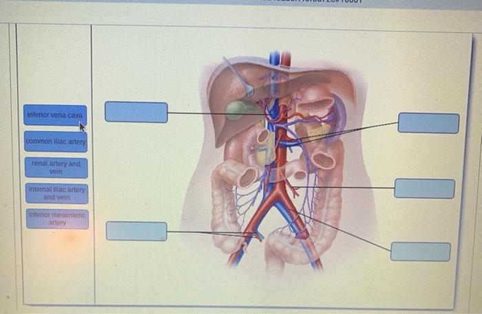 Solved inferior vena cava common fiac artery renal artery | Chegg.com