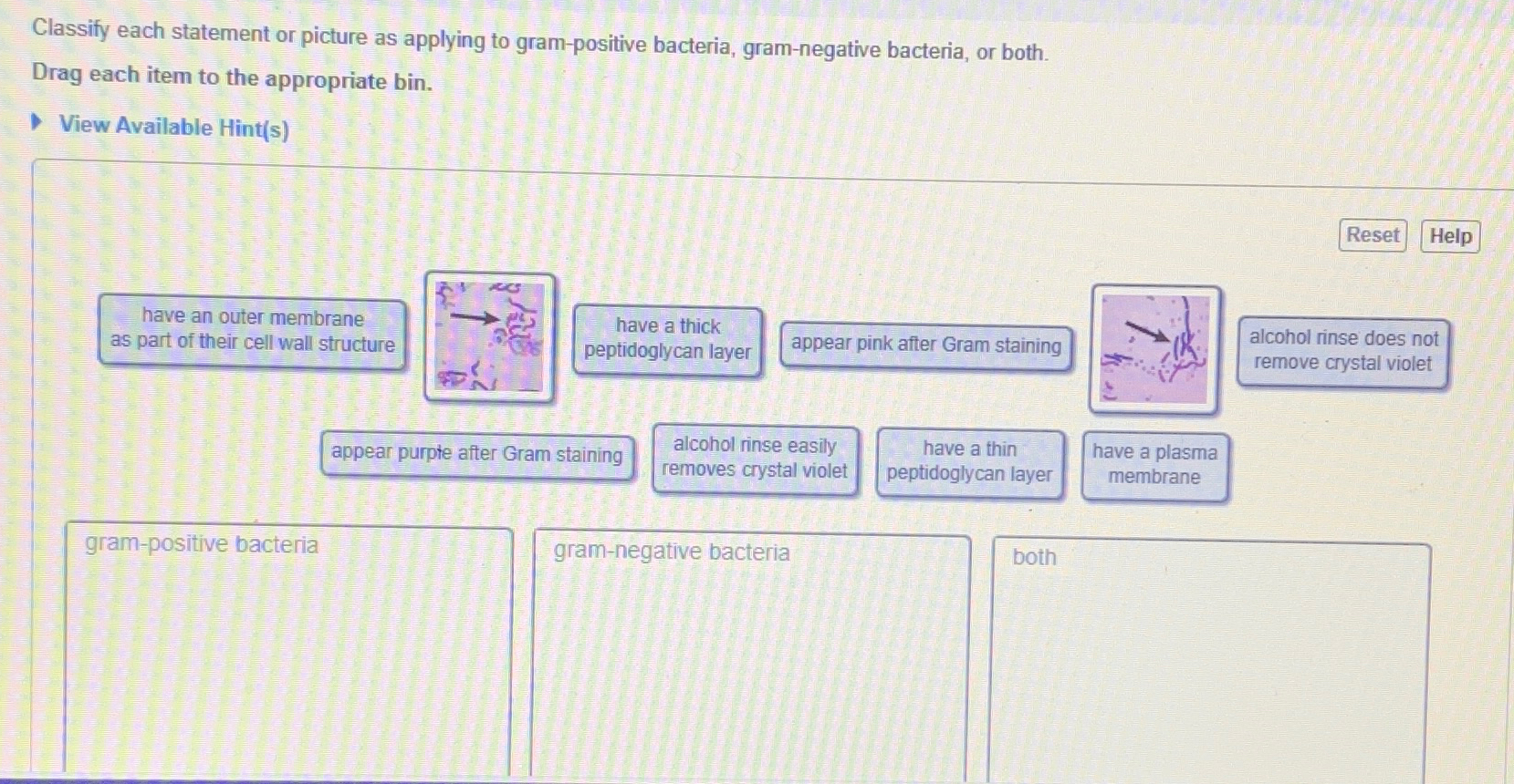 Solved Classify each statement or picture as applying to | Chegg.com