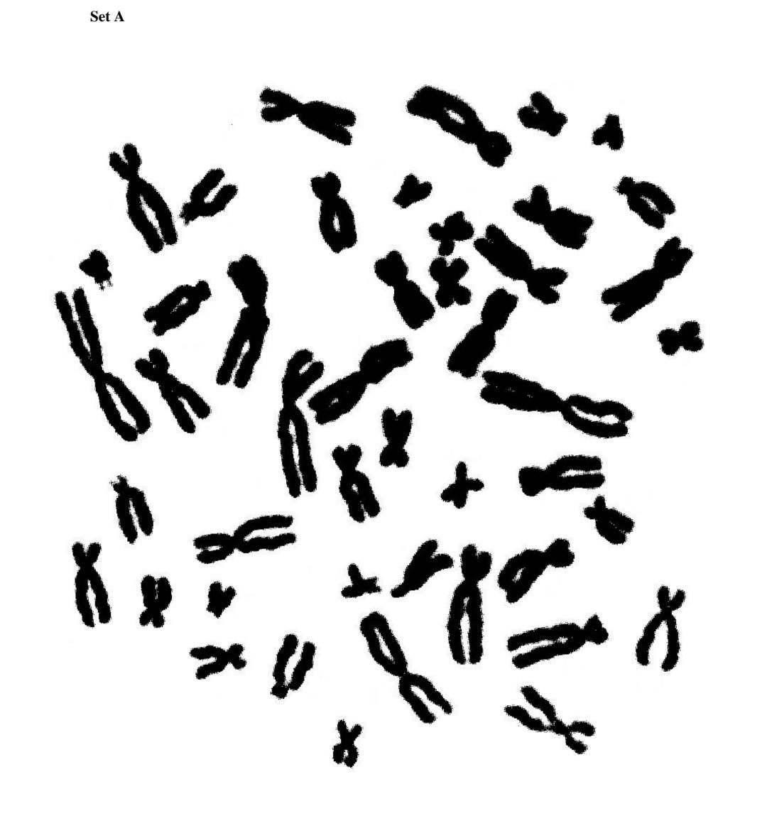 Set A 5. 8 Ai Human Karyotype Form ī 1 3 3 4 5 | Chegg.com