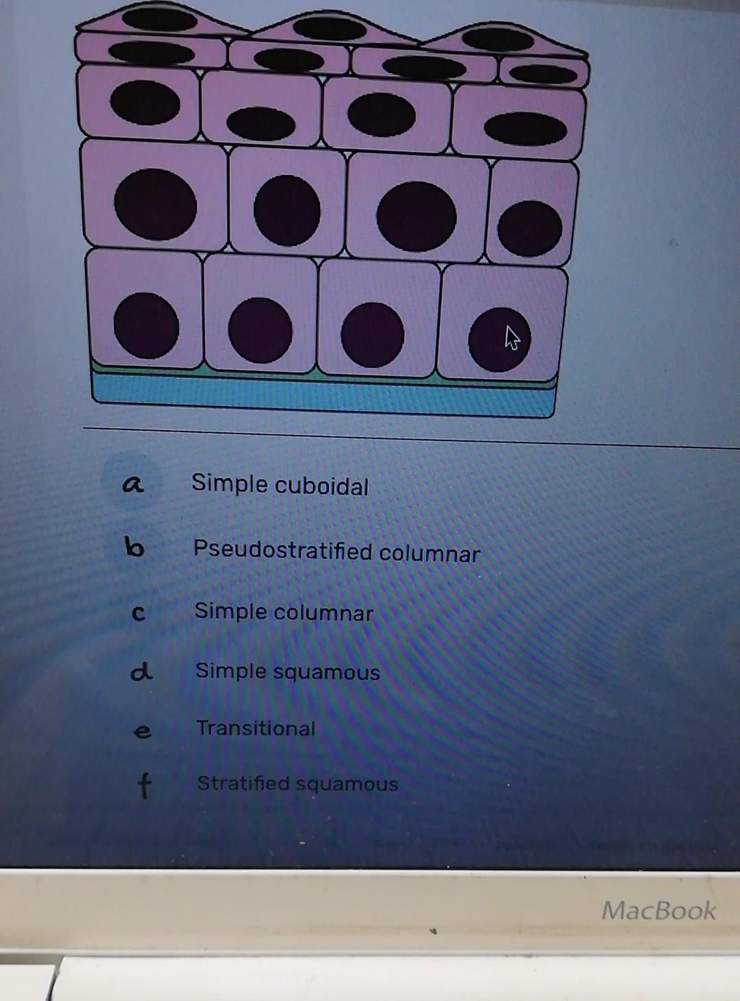 Solved Simple cuboidal b Pseudostratified columnar с Simple | Chegg.com