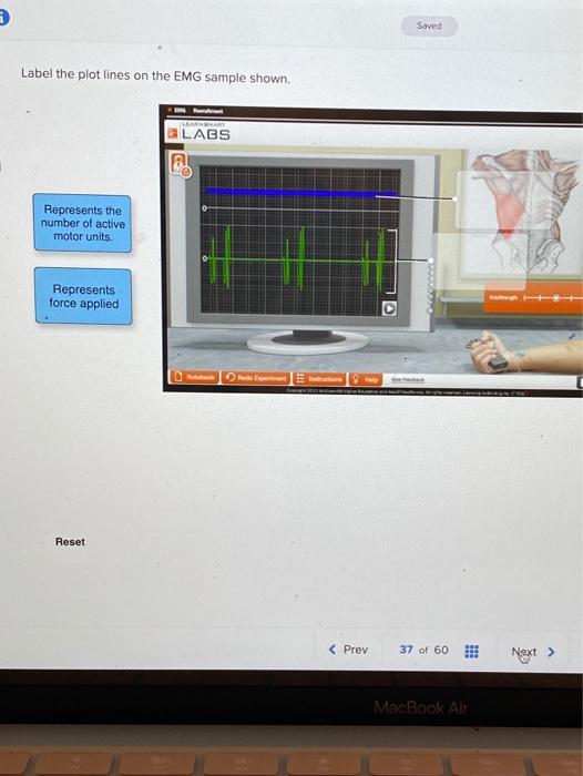 Solved Saved Label the plot lines on the EMG sample shown. | Chegg.com