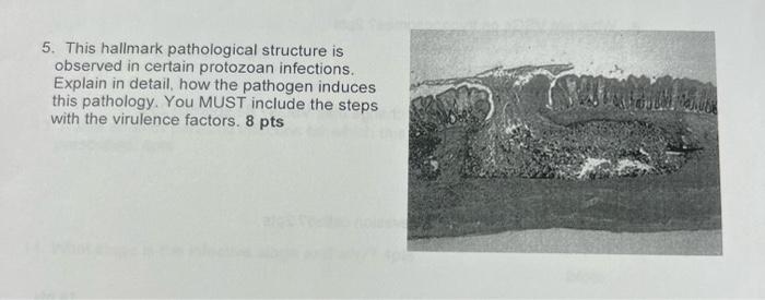 5. This hallmark pathological structure is observed | Chegg.com