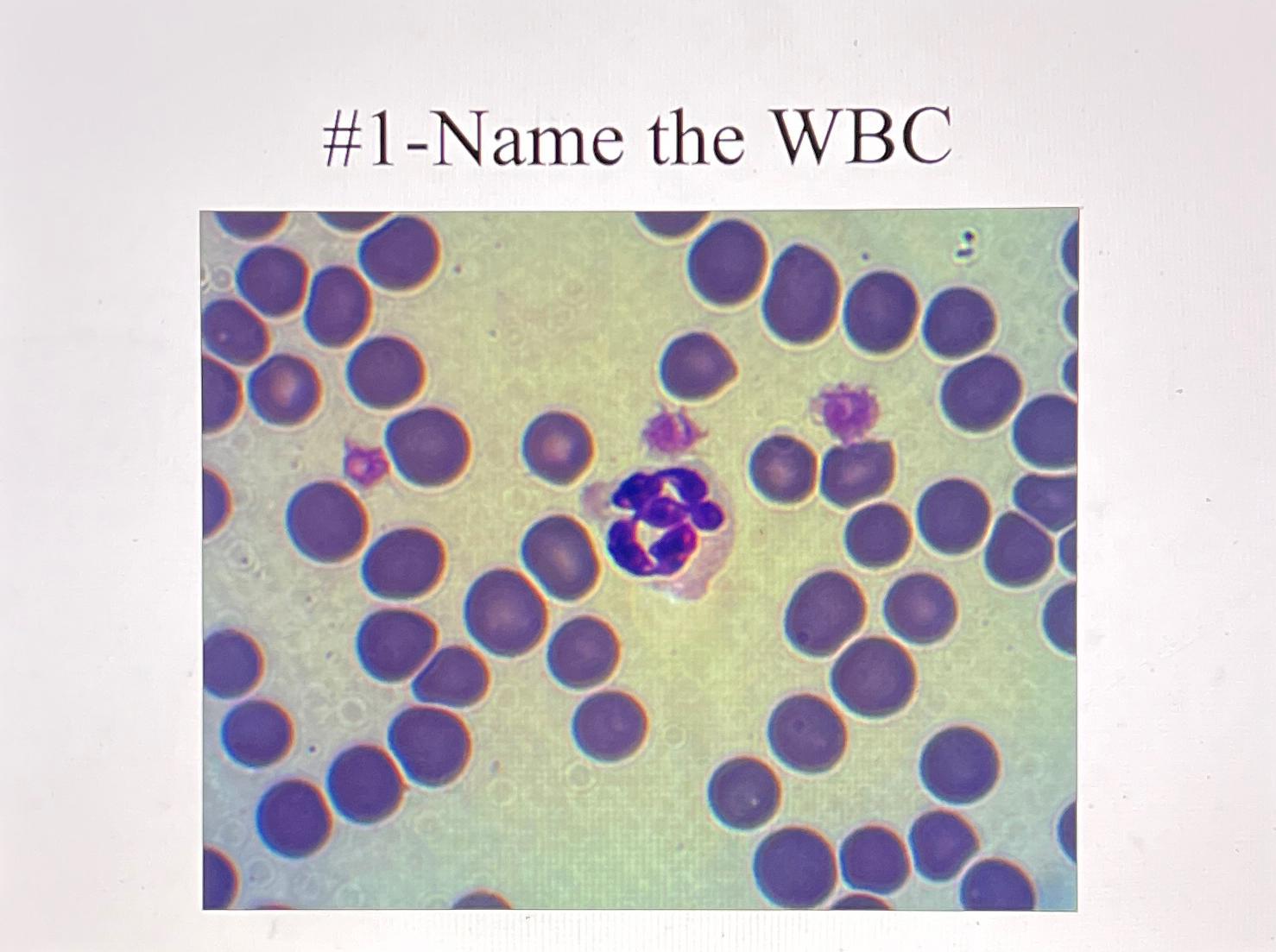 Solved 1 Name The Wbc 