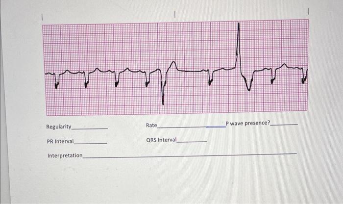 Solved Regularity Rate P wave presence? PR Interval QRS | Chegg.com