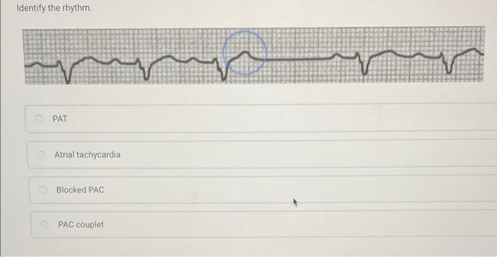 Solved Identify the rhythm. PAT Atrial tachycardia Blocked | Chegg.com