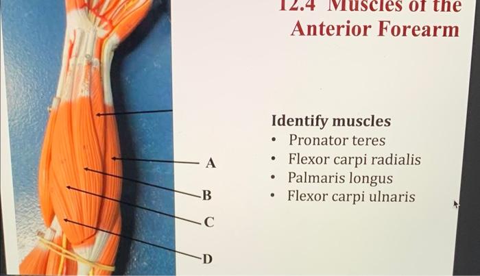 Solved Anterior Forearm Identify muscles - Pronator teres - | Chegg.com