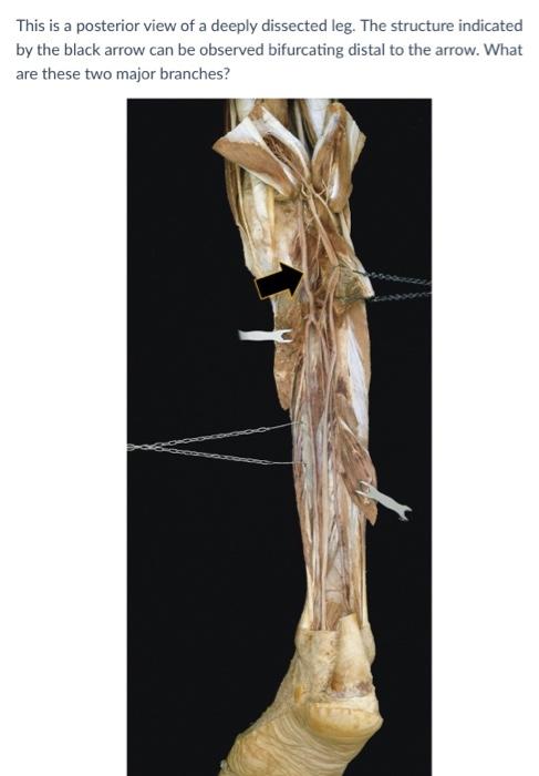 This is a posterior view of a deeply dissected leg. | Chegg.com