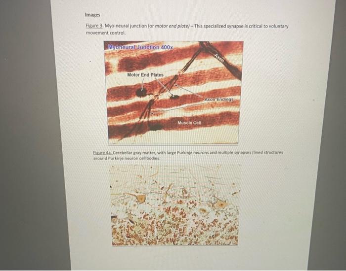 Solved Exercise 1, Examine the microscope slides for neuron | Chegg.com