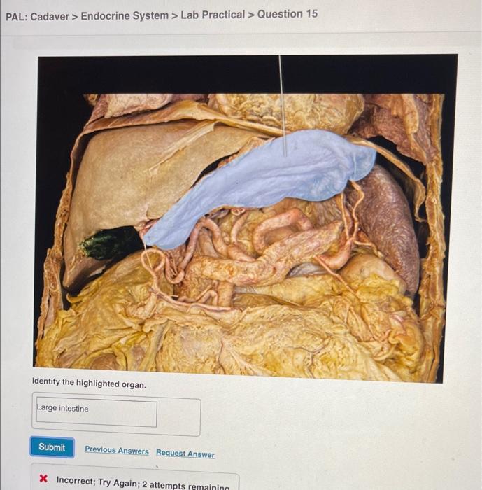 Solved PAL: Cadaver > Endocrine System > Lab Practical > | Chegg.com