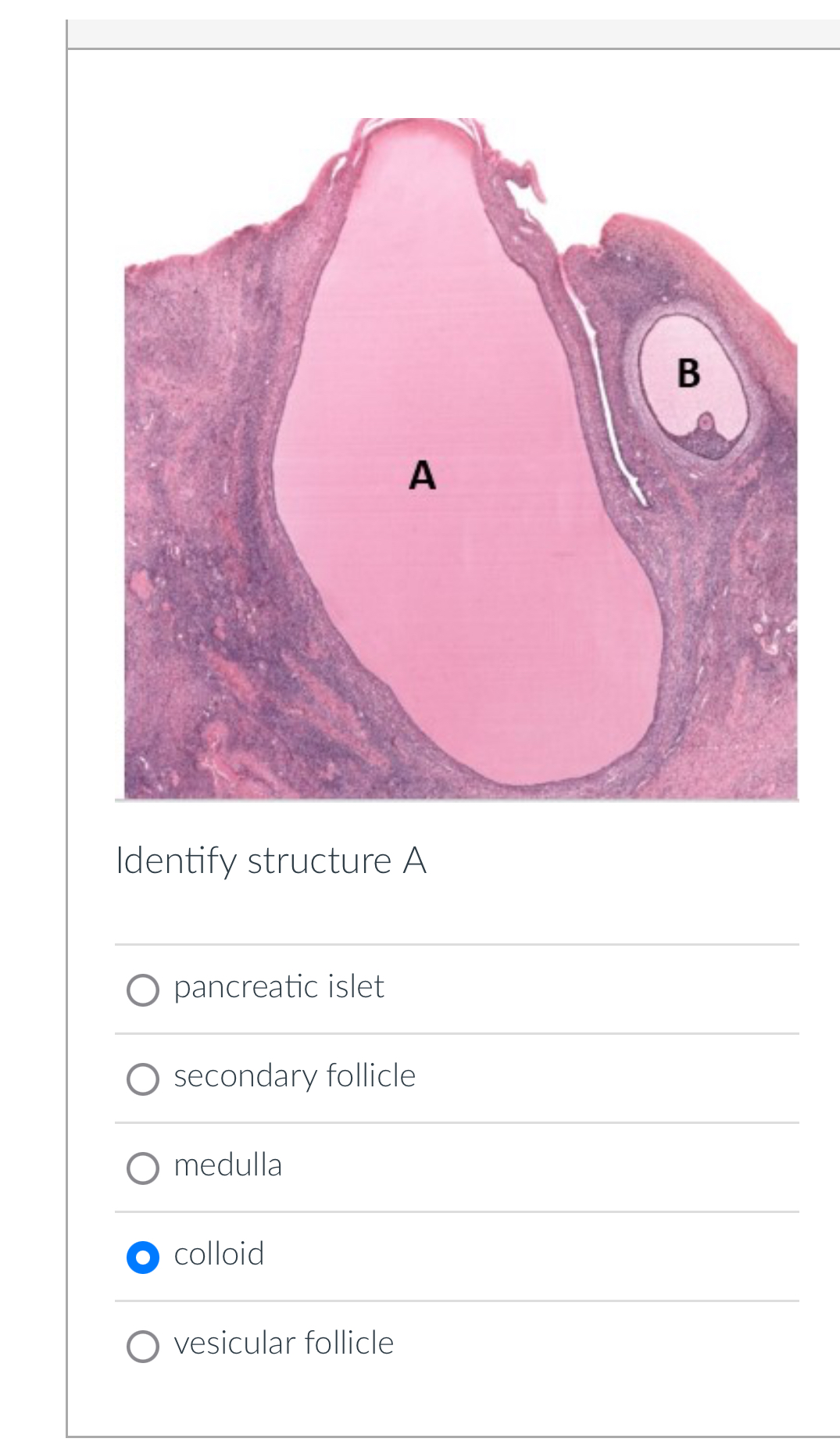 Solved Identify structure Apancreatic isletsecondary | Chegg.com